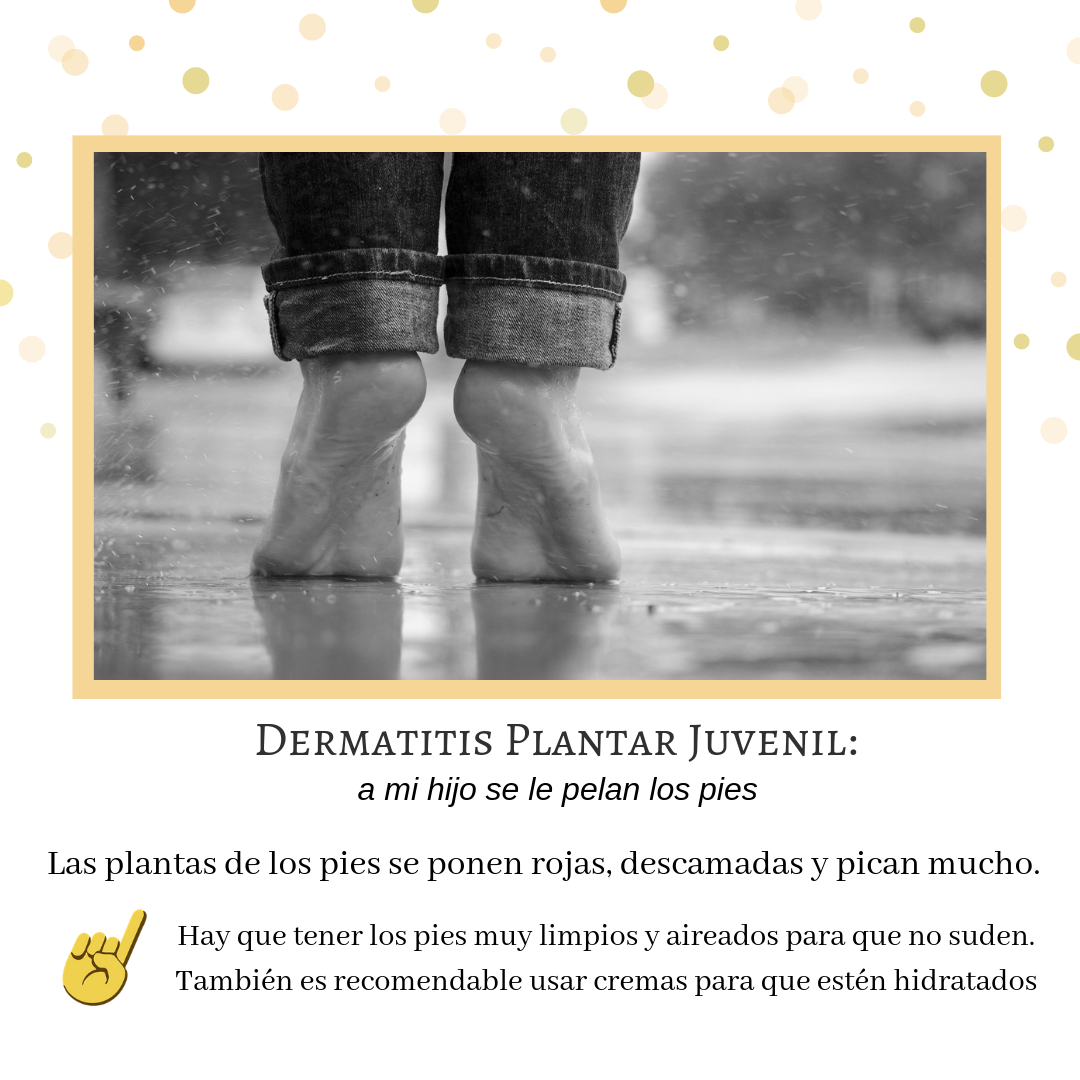 Dermatitis Plantar Juvenil: a mi hijo se le descaman los pies ...