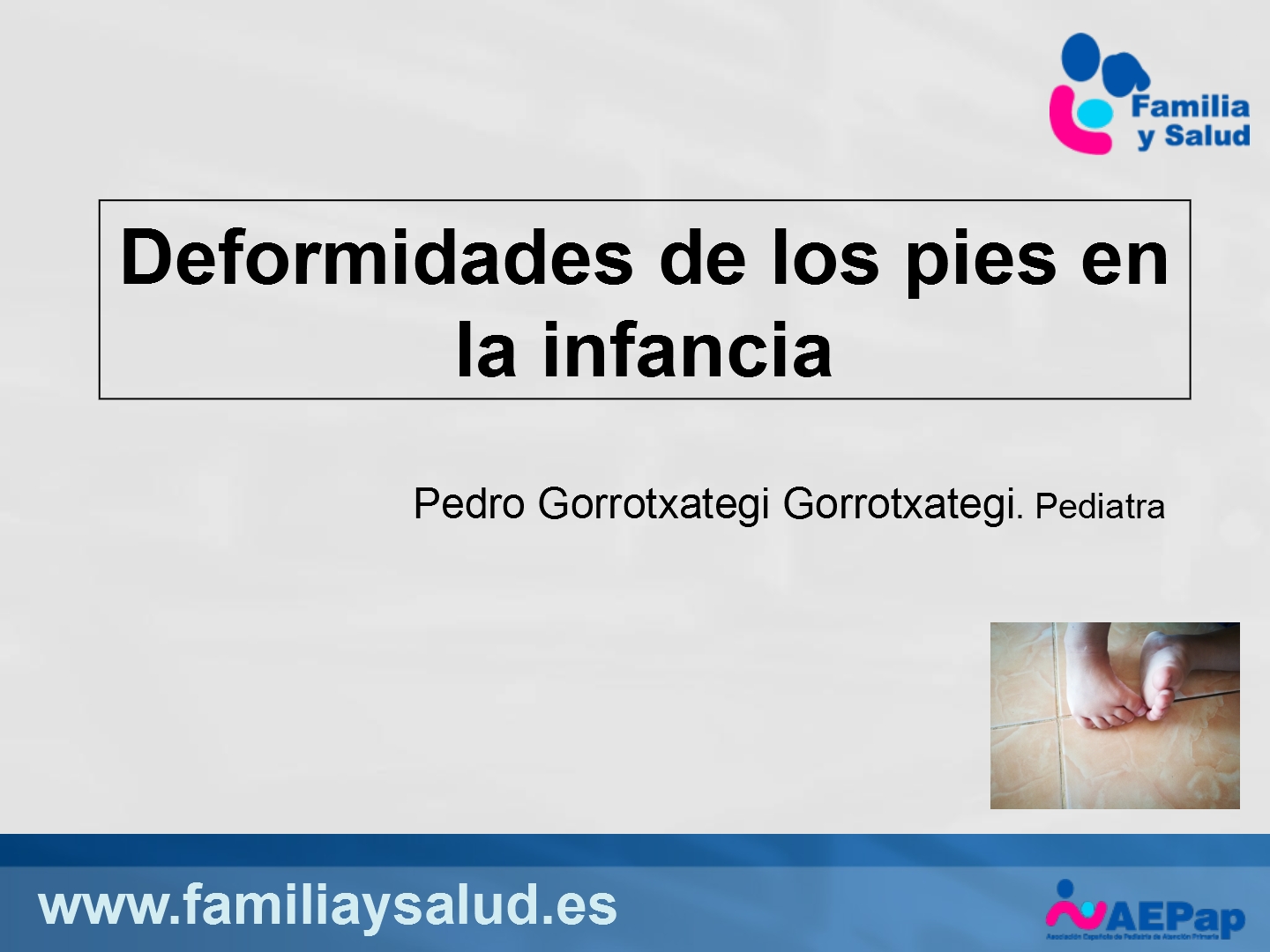 Deformidades de los pies | Familia y Salud