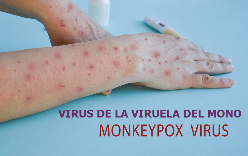 Aprendiendo sobre la viruela del mono | Familia y Salud