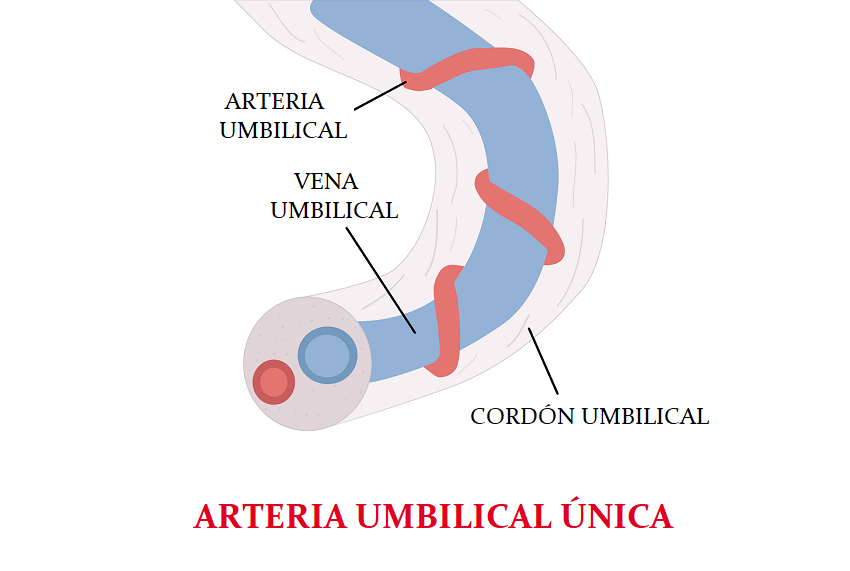 Arterias Umbilicais
