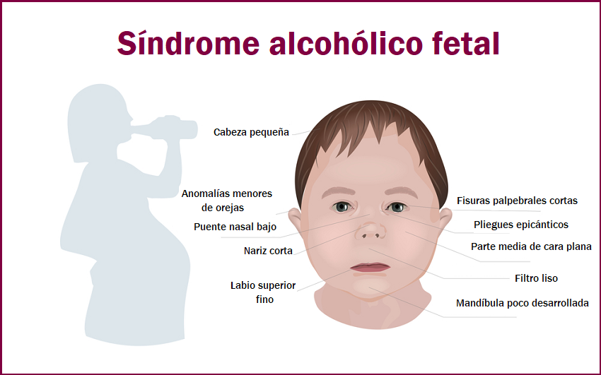 ¿Qué ocurre en el desarrollo del bebé si la madre bebe alcohol ...
