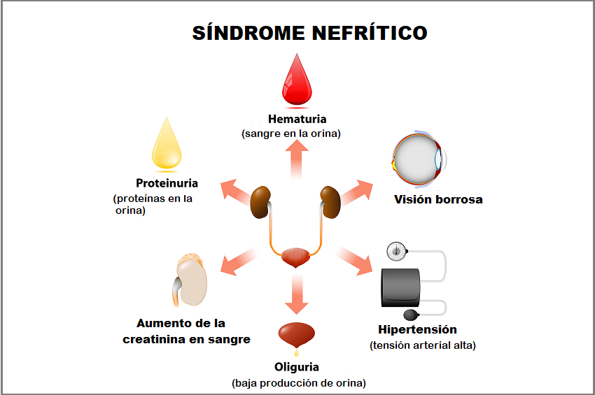 Mi hijo tiene síndrome nefrítico, ¿qué es eso? | Familia y Salud