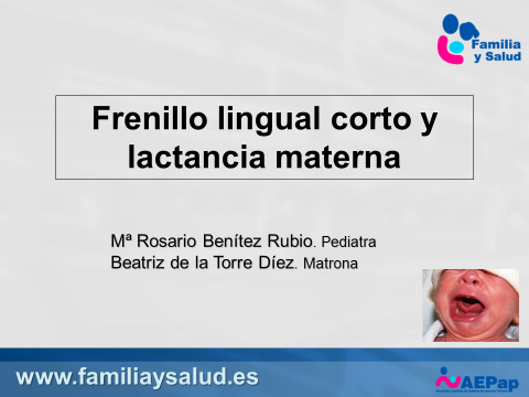 Frenillo lingual corto y lactancia materna | Familia y Salud