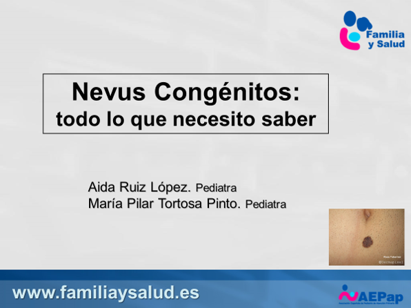 Nevus congénitos: todo lo que necesito saber | Familia y Salud