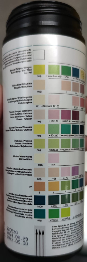 ¿Qué es una tira reactiva de orina? | Familia y Salud