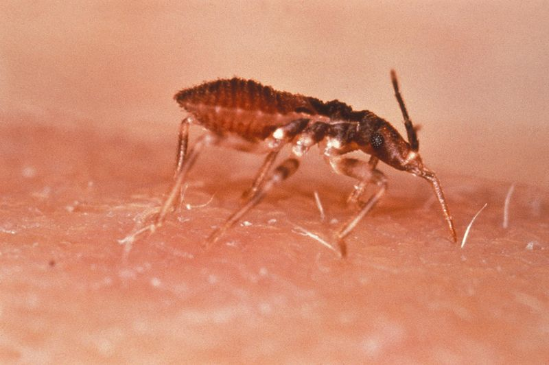¿Qué puedo saber de la enfermedad de Chagas o tripanosomiasis americana ...