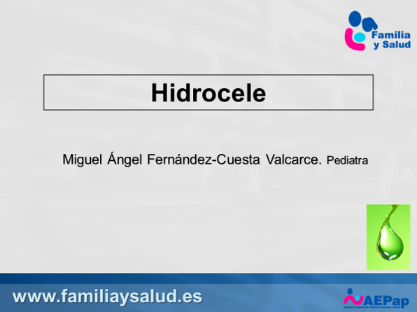 Tratamiento De Hidrocele