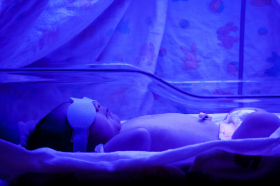 Mi bebé está amarillo: ictericia en el recién nacido | Familia y Salud