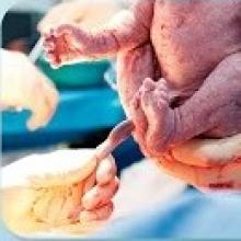 Cuidados del cordón umbilical | Familia y Salud